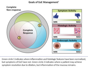 EoE management – EoE Restore | Clinician